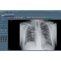 Pacs Software - Picture Archiving And Communication System Price ...