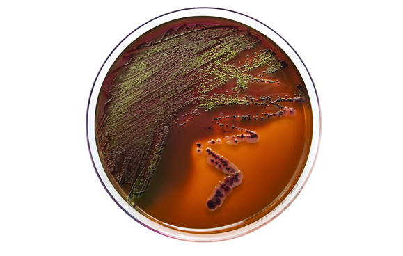 dehydrated culture media - Titan Biotech Ltd, Delhi, Delhi