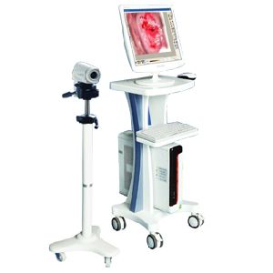 Digital Colposcopes - Colposcopy Machine Price, Manufacturers & Suppliers